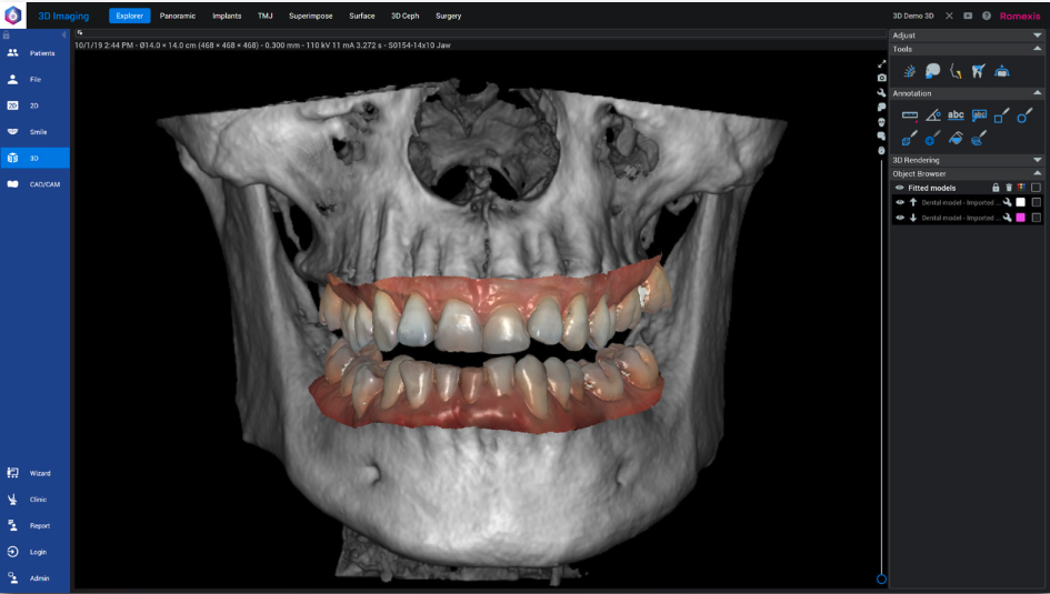 New software releases | Planmeca Romexis